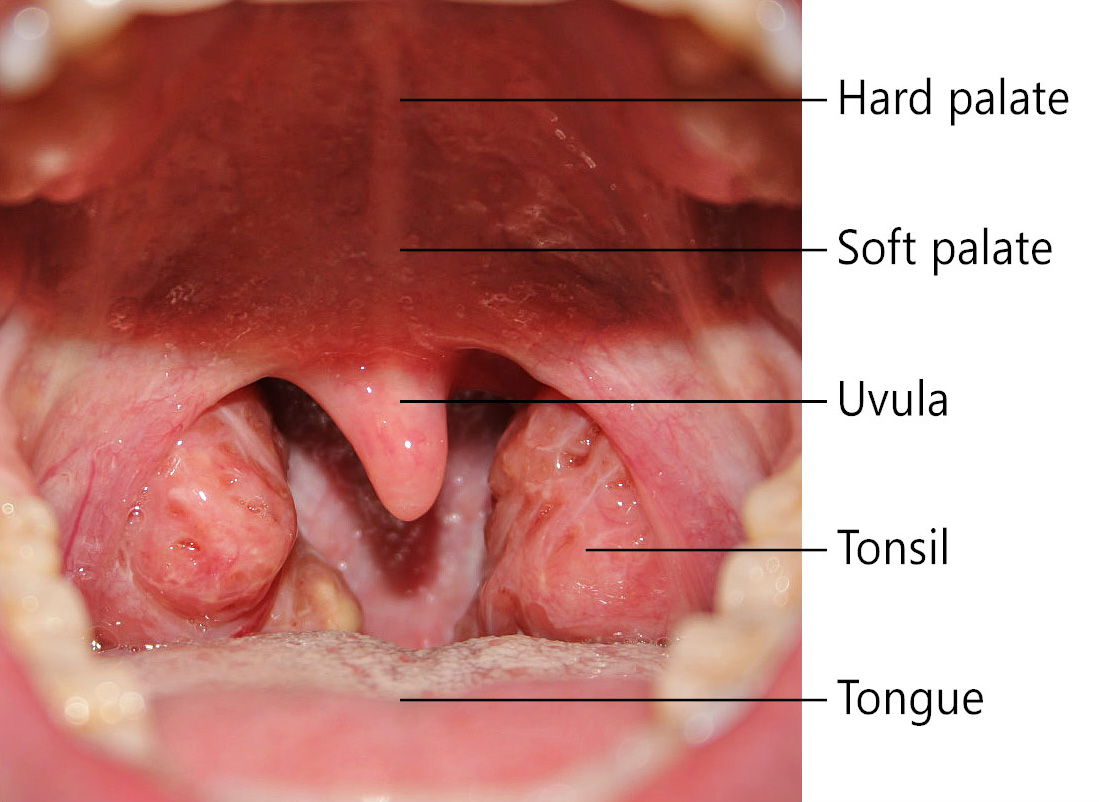 operasi tonsilektomi dengan plasma coblation – Jadwal Praktek Biaya ...